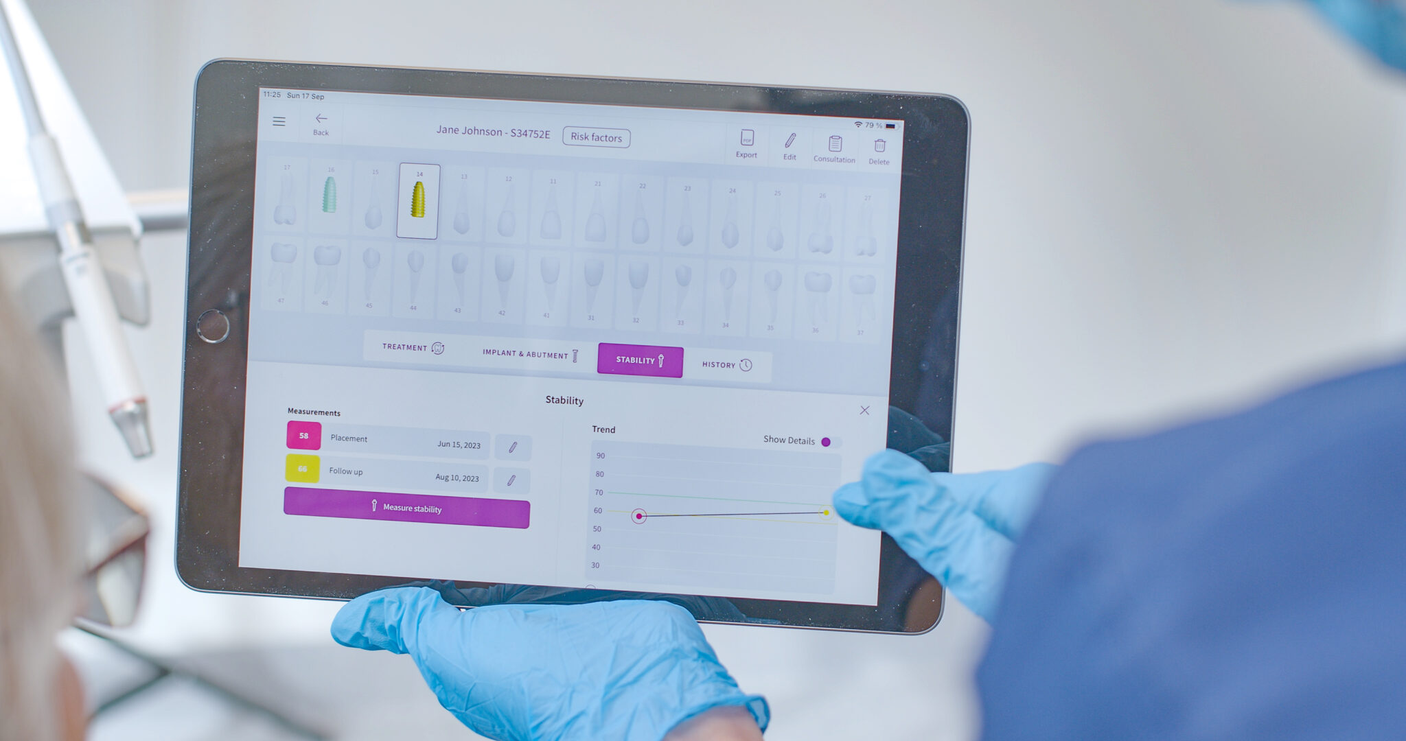 Osstell: Innovations in Dental Implant Success - Osstell®