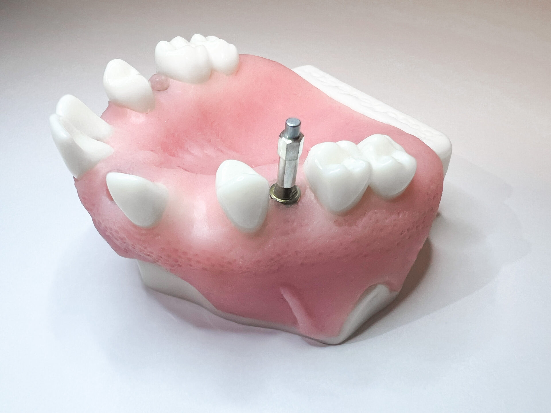 Osstell® - Implant Stability - Implant Stability