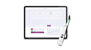 Osstell Classic | Implant stability - Osstell®