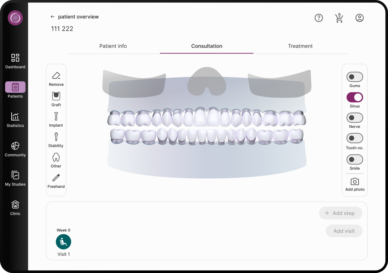 OsstellConnect | Enhance your implant treatments - Osstell®